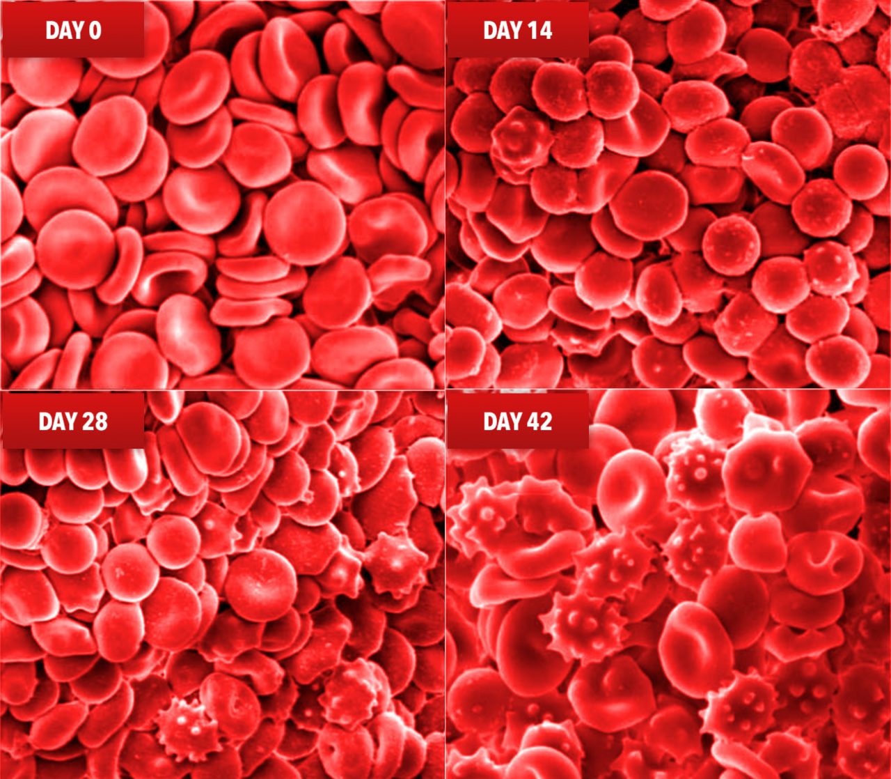 Storage Lesion - Hemanext