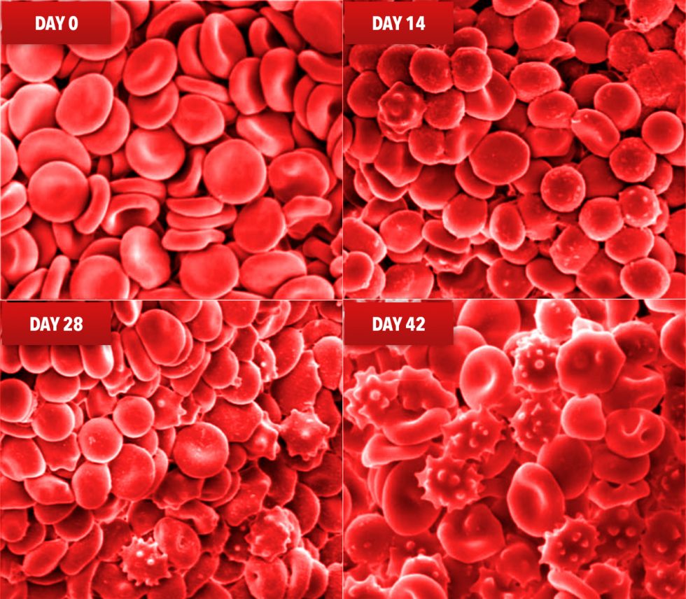 Storage Lesion - Hemanext